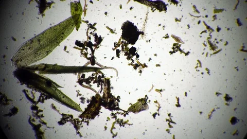 Microcosm in a drop of water, nematode w... | Stock Video | Pond5
