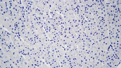 Microscope 400x of cardiac muscle in sec... | Stock Video | Pond5