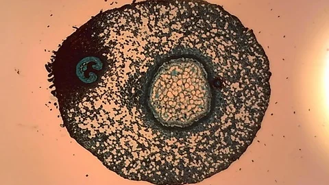 Microscope Fern Root 1 Cross Section x50... | Stock Video | Pond5