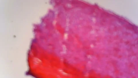 Microscope Human Fibrous Connective Tiss... | Stock Video | Pond5