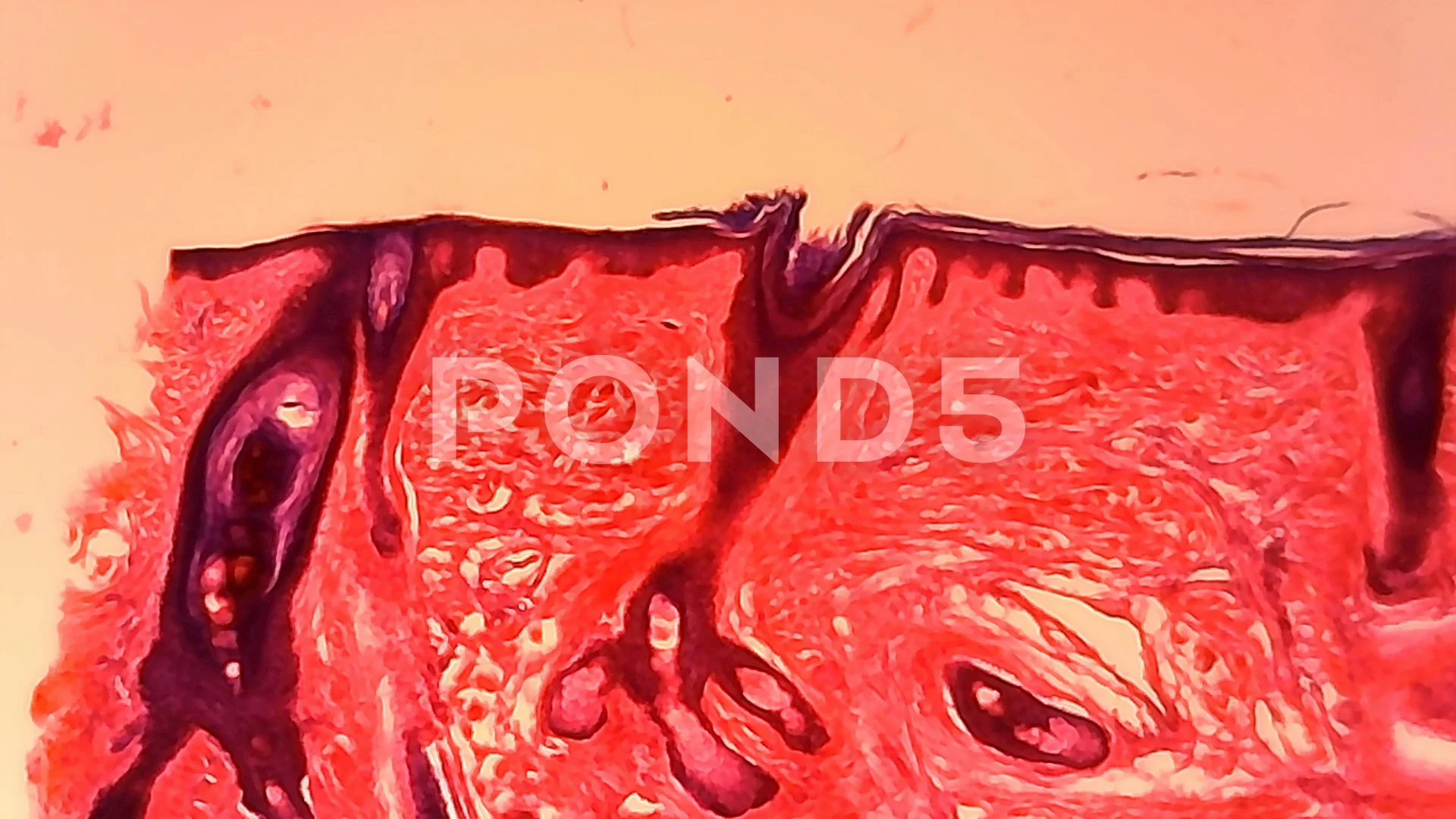 Red Hair Under Microscope