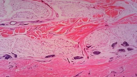 Microscope Human Skin Sweat Gland 800x | Stock Video | Pond5