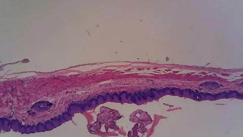 Microscope Human Stratified Squamous Epi... | Stock Video | Pond5