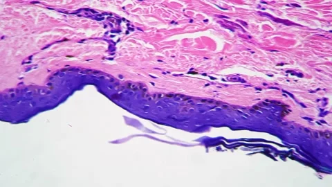 Microscope image of human skin with swea... | Stock Video | Pond5