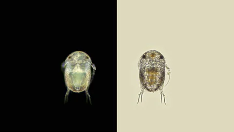 Microscope larva under a microscope, par... | Stock Video | Pond5
