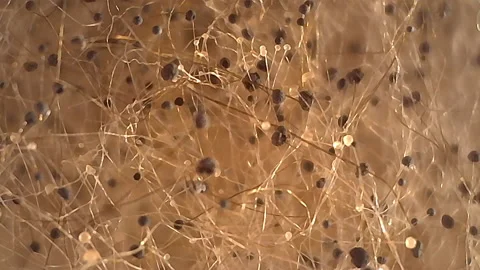 Fungi Microscope Stock Video Footage | Royalty Free Fungi Microscope ...