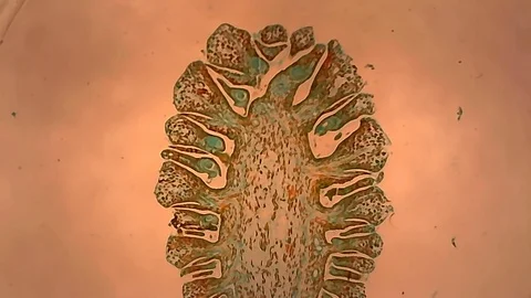 Microscope Pine Cone Female Longitudinal... | Stock Video | Pond5