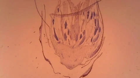 Microscope Polytrichum Archegonia Longit... | Stock Video | Pond5
