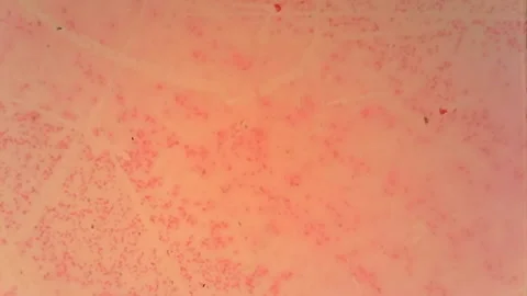 Blood Smear Stock Footage ~ Royalty Free Stock Videos | Pond5