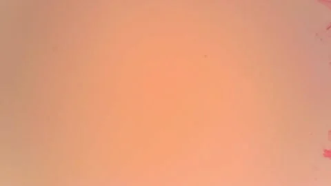 Microscope Rabbit Hyaline Cartilage x120... | Stock Video | Pond5