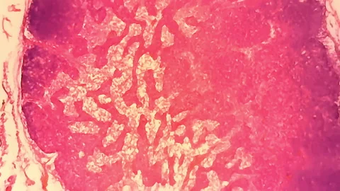 Microscope Rabbit Lymph Node Section x12... | Stock Video | Pond5