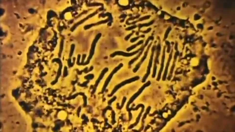 microscope view of Chromosome synapsis s... | Stock Video | Pond5