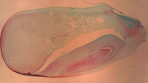 Longitudinal Section Stock Video Footage | Royalty Free Longitudinal ...