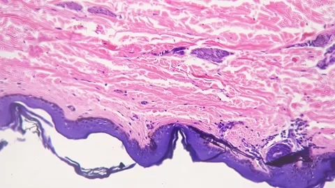 Microscopic 200x view of human skin with... | Stock Video | Pond5