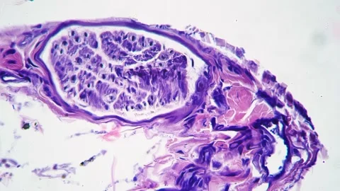 Microscopic 400x image of human skin wit... | Stock Video | Pond5