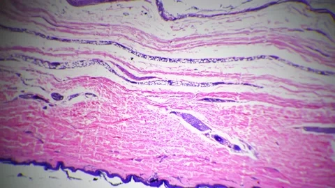 Microscopic 40x view of human skin with ... | Stock Video | Pond5