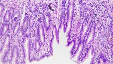 Microscopic footage of pyloric region in... | Stock Video | Pond5