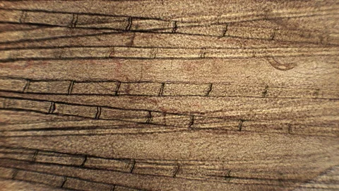 A microscopic parasite attached to the f... | Stock Video | Pond5