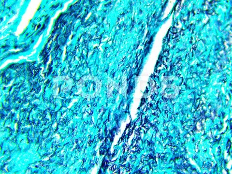 Microscopic photography of mucous membrane of the appendix, color test ...