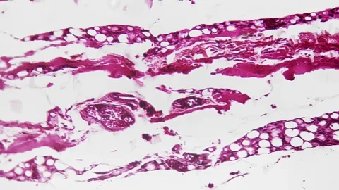 Microscopic slide 200x of human skin sec... | Stock Video | Pond5