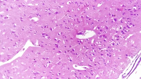 Microscopic slide with human cerebrum in... | Stock Video | Pond5