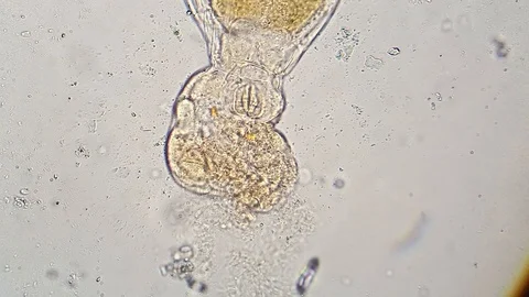 Microscopic view of pond drop | Stock Video | Pond5