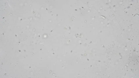 The Microscopic World. Sperm under the m... | Stock Video | Pond5