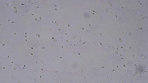 The Microscopic World. Sperm under the m... | Stock Video | Pond5