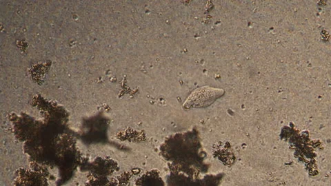 Microscopy of Amoeba limax in the water ... | Stock Video | Pond5