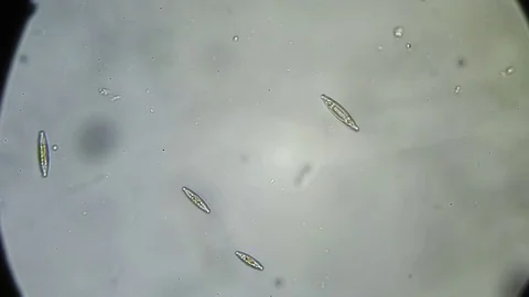 Diatoms Under Microscope Labeled