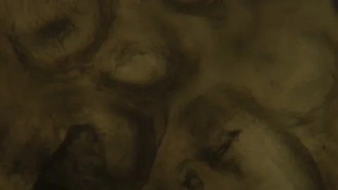 Microscopy of dry skin. Magnification 15... | Stock Video | Pond5