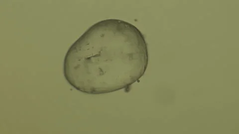 Microscopy of human blood cell test. Mag... | Stock Video | Pond5