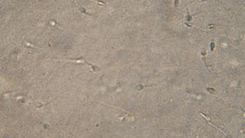 Microscopy of human sperm . Magnificatio... | Stock Video | Pond5