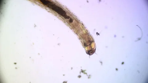 Microscopy - Mosquito Larvae, under the ... | Stock Video | Pond5