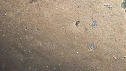 Microscopic Protozoa Stock Video Footage | Royalty Free Microscopic ...