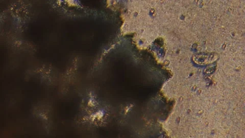 Parasitic Protozoa Stock Video Footage | Royalty Free Parasitic ...