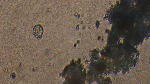 Parasitic Protozoa Stock Video Footage | Royalty Free Parasitic ...