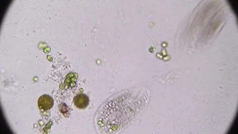 Microscopy - Stylonychia Ciliophora, und... | Stock Video | Pond5