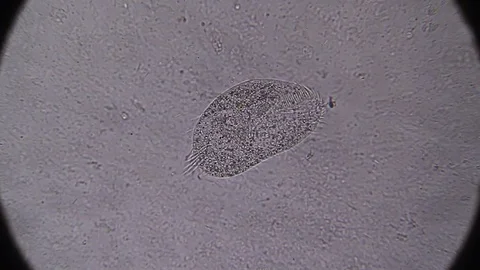 Microscopy - Stylonychia Ciliophora, und... | Stock Video | Pond5