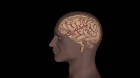 Migraine mechanism, neuron misfire and d... | Stock Video | Pond5
