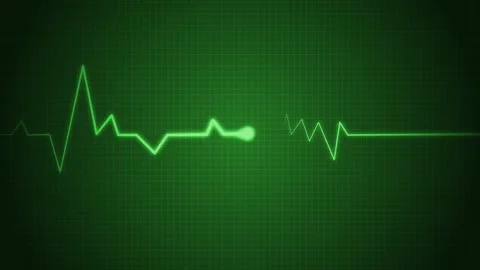 Minimal EKG Line Pulse Animation, Animat... | Stock Video | Pond5