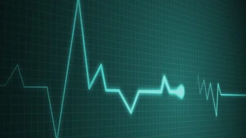 Minimal EKG Line Pulse Animation, Animat... | Stock Video | Pond5