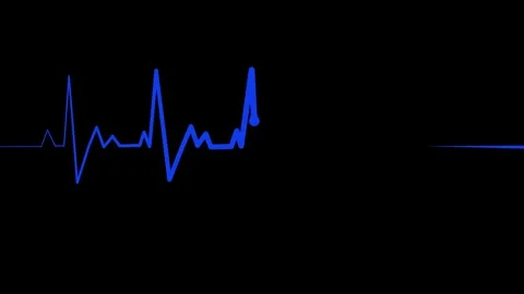Minimalist Heartbeat ECG Line Animation,... | Stock Video | Pond5