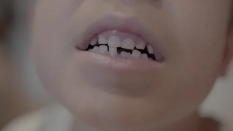 Missing tooth. Close up on a smiling kid... | Stock Video | Pond5
