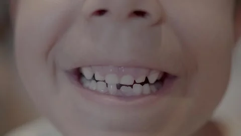 Missing tooth. Close up on a smiling kid... | Stock Video | Pond5
