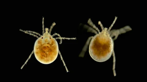 mite Hydrachnidia under the microscope | Stock Video | Pond5