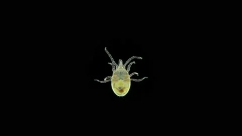 Mite of the order Mesostigmata under a m... | Stock Video | Pond5