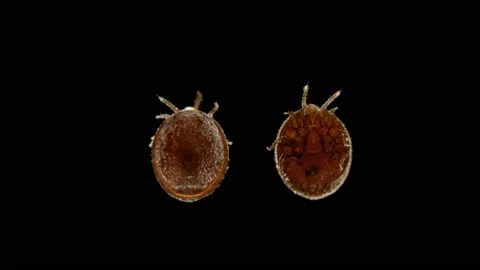 mite under a microscope, Acari, whose ar... | Stock Video | Pond5