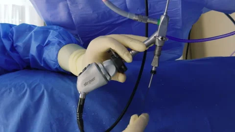 Modern endoscopic device in gloved hands... | Stock Video | Pond5