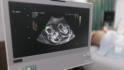 Modern Pregnancy Screening Machine Detec... | Stock Video | Pond5